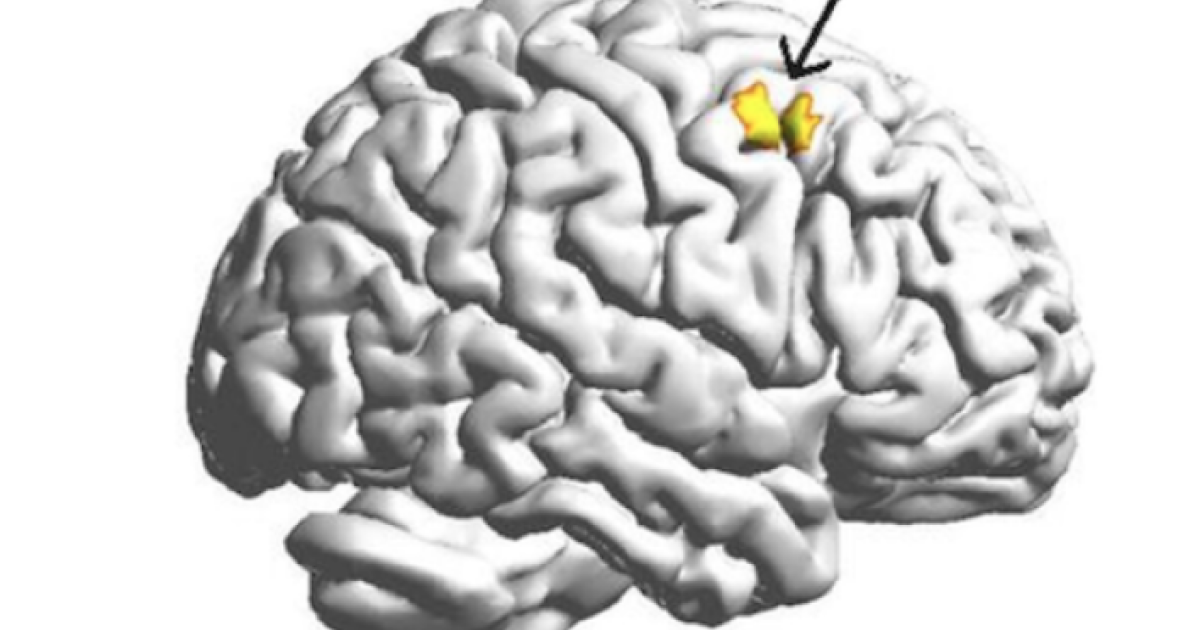 Study Finds Stuttering Anticipation Prompts Unique Activity in the ...